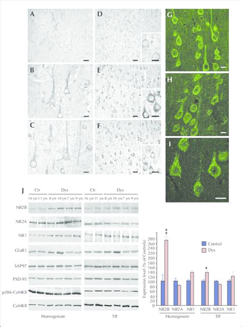 Nmda Receptor Expression And Composition Are Altered In Type Ia Fcd Download Scientific Diagram