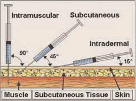 Angle Of Injection ~ Nursing