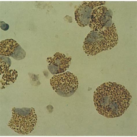 Cyanide Resistant Peroxidase Staining Of Cord Blood Mnc A Uninduced