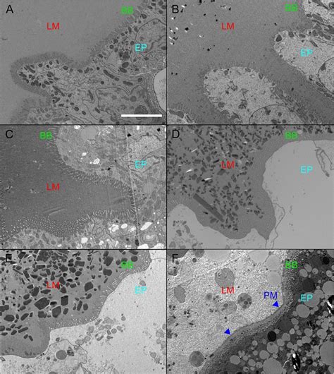 Absence Of A Detectable Peritrophic Matrix In The X Cheopis Midgut