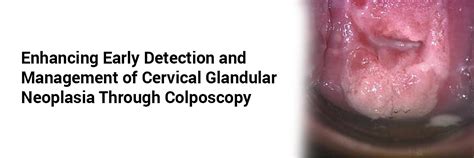 Enhancing Early Detection And Management Of Cervical Glandular