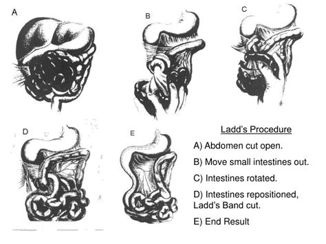 Ppt Gastro Intestinal Powerpoint Presentation Id3943705