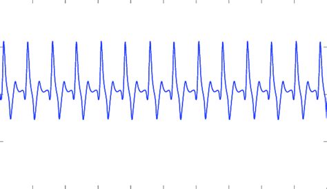 Ecg Signal For A Normal Heartbeat Generated By The Takagi Sugeno Fuzzy Download Scientific