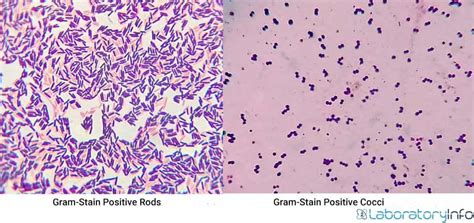 Bacteriology Cell Wall Gram Staining Classification Of Gram Positive
