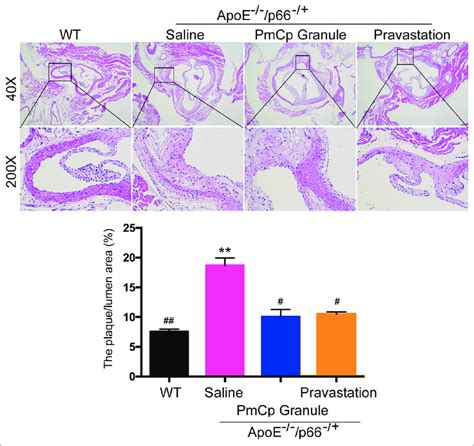 Polygonum Multiflorum And Codonopsis Pilosula Granule Effectively