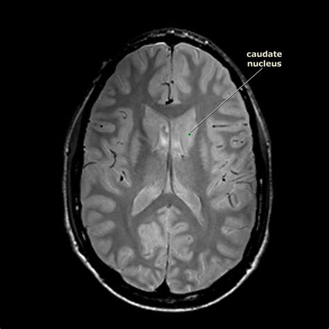 Caudate