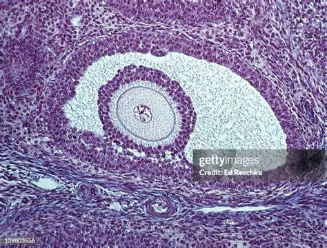 Ovary Follicles Photos And Premium High Res Pictures Getty Images