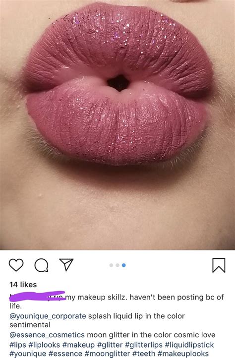 The Worst Prolapsed Anus” Photo Ive Seen Yet Ryouniqueamua