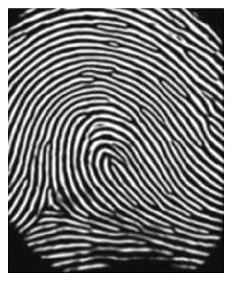 Effect Of Fingerprint Image Preprocessing A Original Image B