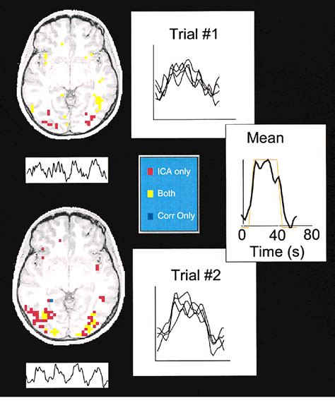 Figure 1 From Analysis Of Fmri Data Byblind Separation Into Independent