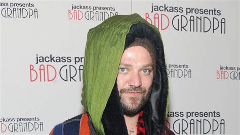 Jackass Bam Margera Just Showed Off His New Face…