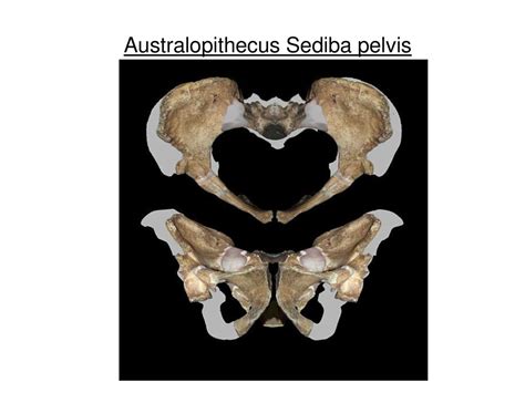 Australopithecus Sediba Pelvis