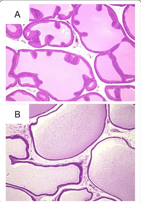 Observation Of Epithelia And Stromal Cells In Ventral Prostate Using