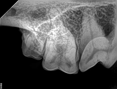 Transorbital Radiographs For Maxillary Molar Teeth Clinicians Brief