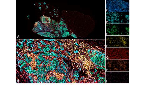7 Color Multiplex Immunofluorescence For Spatial Biology With A Digital Slide Scanner