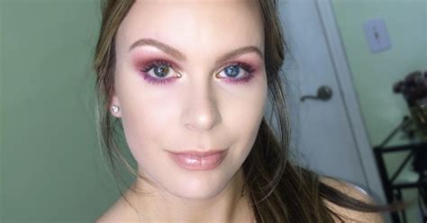 Mom Was Excessively Bleeding After Giving Birth It Was Leukemia