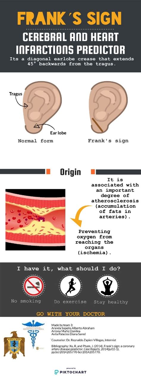 Franks Sign DivulgaciÓn CientÍfica Ug