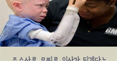 카드뉴스 주술사를 무찌를 의사가 되겠다는 알비노 흑인 소년