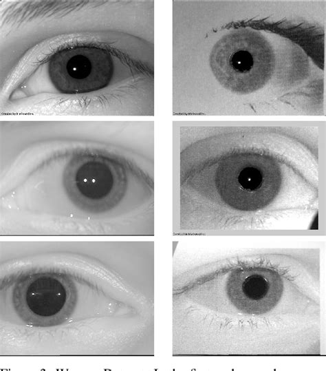 Cnn Hyperparameter Tuning Applied To Iris Liveness Detection