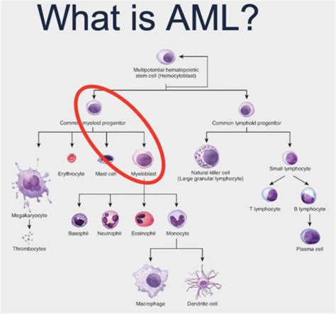 Aml All Flashcards Quizlet