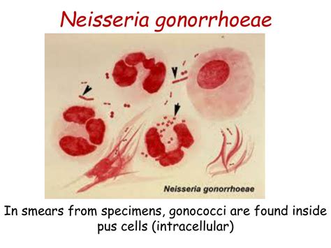 Ppt Neisseria Powerpoint Presentation Free Download Id3121064