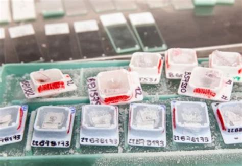 Frozen Tissue Sectioning Protocol Creative Bioarray Creative Bioarray