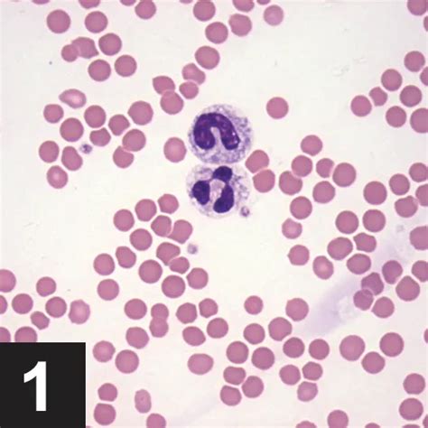 Top 5 Leukogram Patterns Clinicians Brief