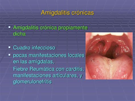 Ppt Orofaringe Powerpoint Presentation Free Download Id 2181053