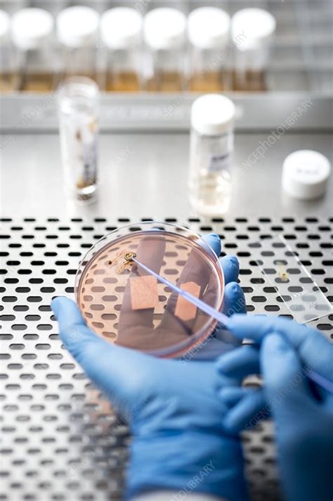 Faecal Sample Analysis Stock Image C023 2927 Science Photo Library