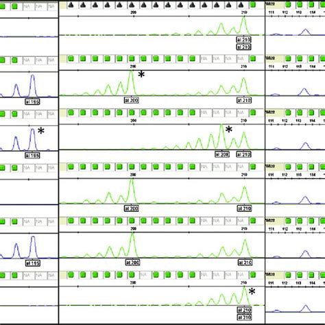 Sample Electropherograms For 3 Of The 12 Dna Microsatellite Loci