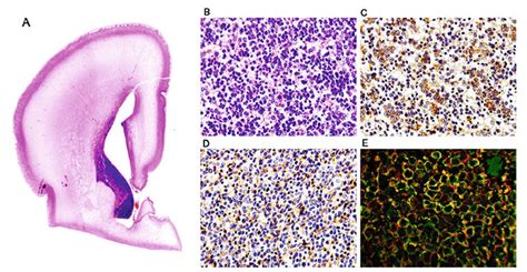 Ihc And Icc Experiment Protocol Creative Diagnostics