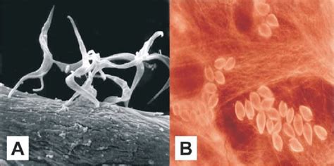 As Duas Principais Formas Do Trypanosoma Cruzi Em Hospedeiros