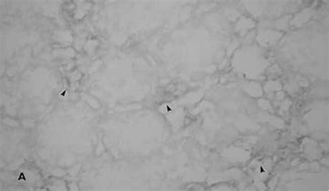 Anti Endothelin [clone Endo 20 2101 70] Leinco Technologies