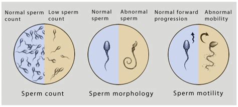 Medical Laboratory Technology Sop Semen Analysis
