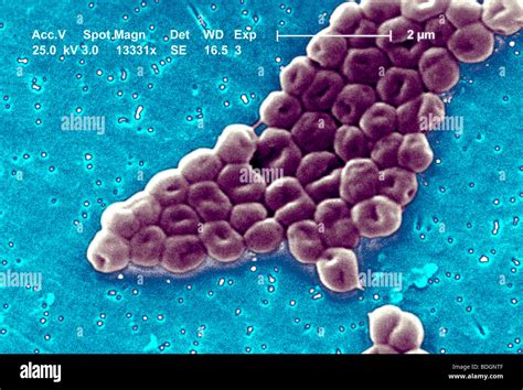 Bacteria Acinetobacter Baumannii Fotos E Imágenes De Stock Alamy