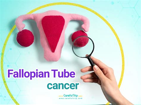 Fallopian Tube Cancer11zonwebp