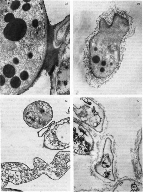 Transmission Electron Microscopy Using Ruthenium Red Staining Of
