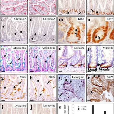 Altered Goblet Cell Differentiation In The Colon Of Sox9 Deficient