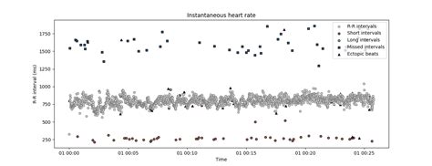 Detecting And Correcting Artefacts In Rr Time Series — Systole 000 Documentation