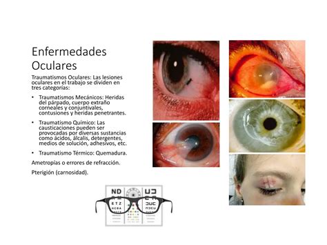Salud Ocular Partes Del Ojo Y Como Prevenir Enfermedades Oculares Pdf