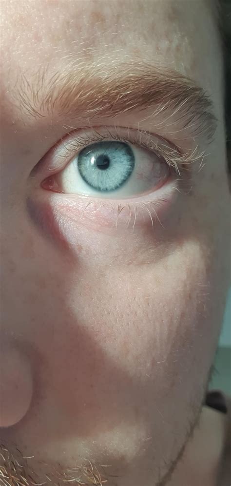 Very Light Blue Eyes