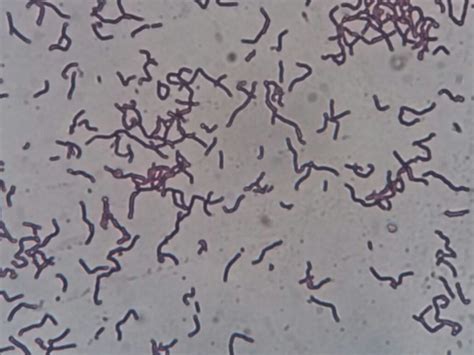 Coconut Water Based Probiotic Drink Proposal Evaluation Of