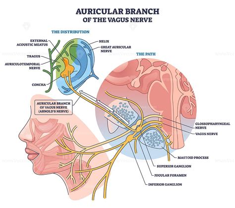 Vagus Nerve Auricular Branch Shown Coursing To The Ear Mapping Its