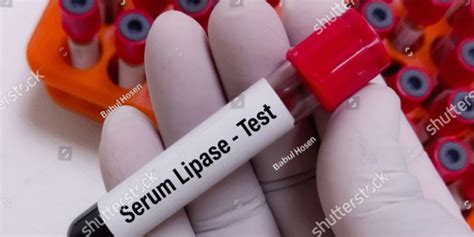 Best Serum Lipase Test 01797522136