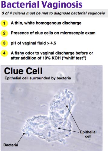 Clue Cells