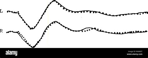 Effects Of Phonetic Processing And Effects Of Phonetic Processing And