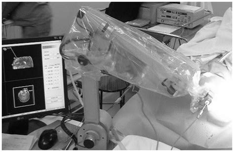 Robot Assisted Stereotactic Puncture Surgery The Image Shown On The Download Scientific