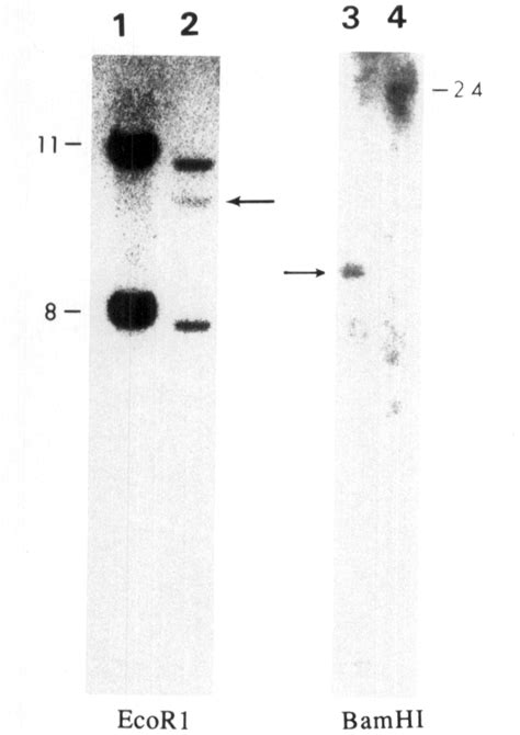 Tcrb Chain Rearrangement In Plasmacytoid T Cell Lymphoma Lanes L And 4