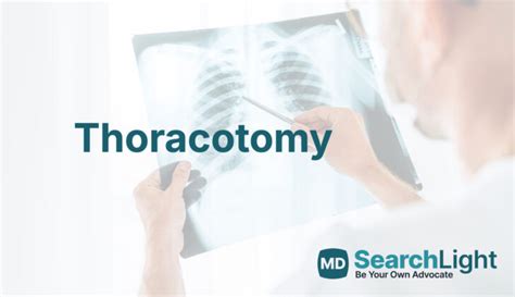 Thoracotomy Thoracic Surgery Md Searchlight