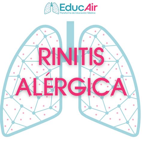 Rinitis Alérgica Educair Cursos Gratuitos Para Médicos